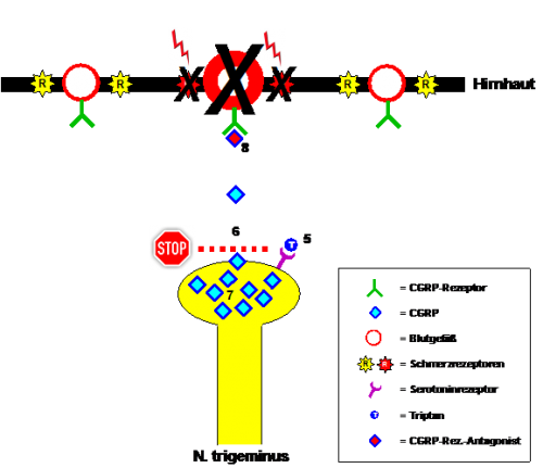 CGRP Impfung gegen Migräne - Schmerzklinik Kiel
